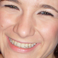 Patricia Sarrión - UCLA School of Dentistry