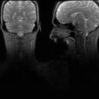 Andrew Haun - University of Wisconsin-Madison