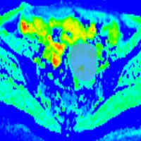 peian hu - Children's National Medical Center