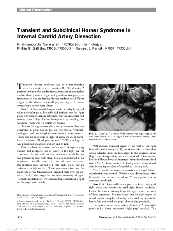 (PDF) Transient and Subclinical Horner Syndrome in Internal Carotid ...