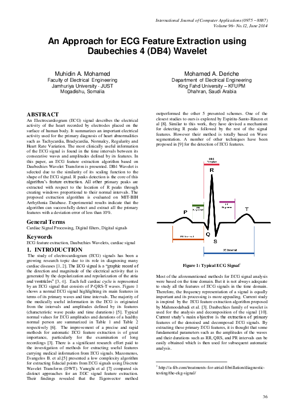 Pdf An Approach For Ecg Feature Extraction Using Daubechies 4 Db4