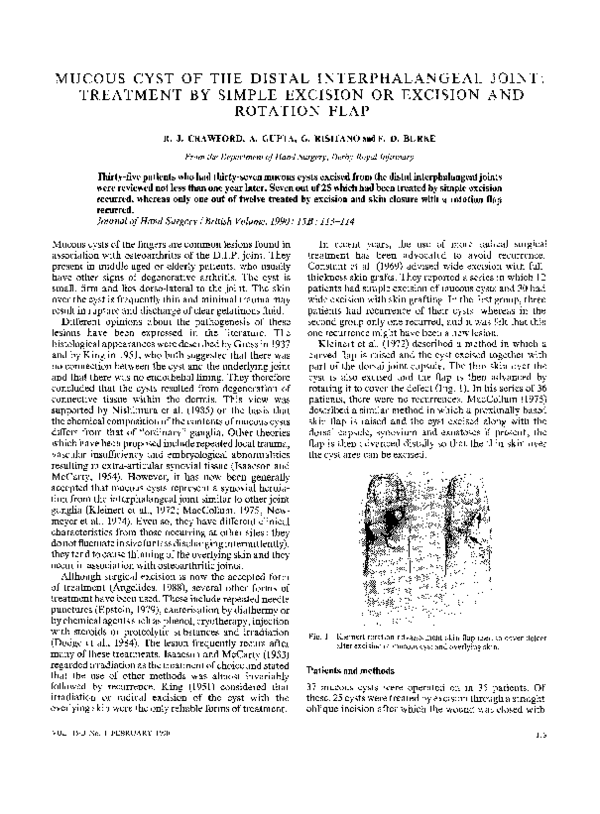(PDF) Mucous cyst of the distal interphalangeal joint: Treatment by ...