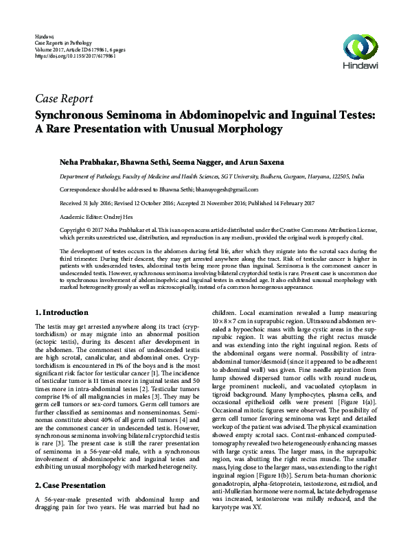 (PDF) Synchronous Seminoma in Abdominopelvic and Inguinal Testes: A ...