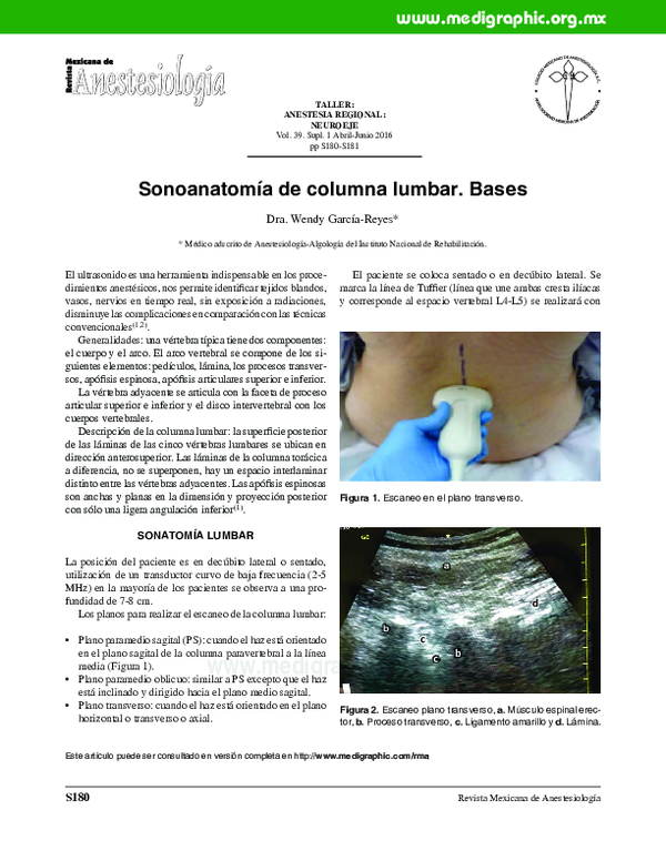 (PDF) Sonoanatomía de columna lumbar. Bases