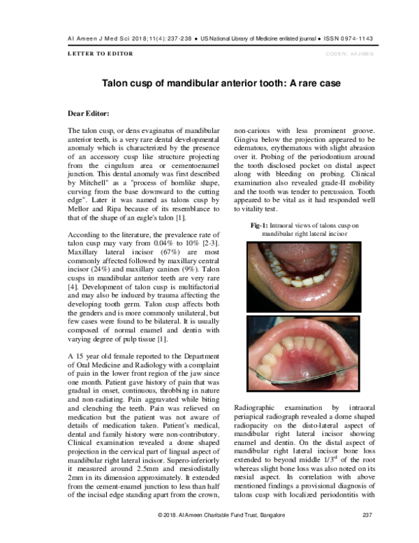 (PDF) Talon cusp of mandibular anterior tooth: A rare case