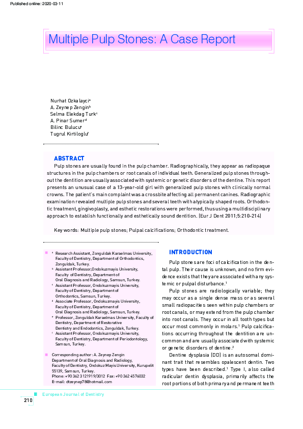 (PDF) Multiple Pulp Stones: A Case Report