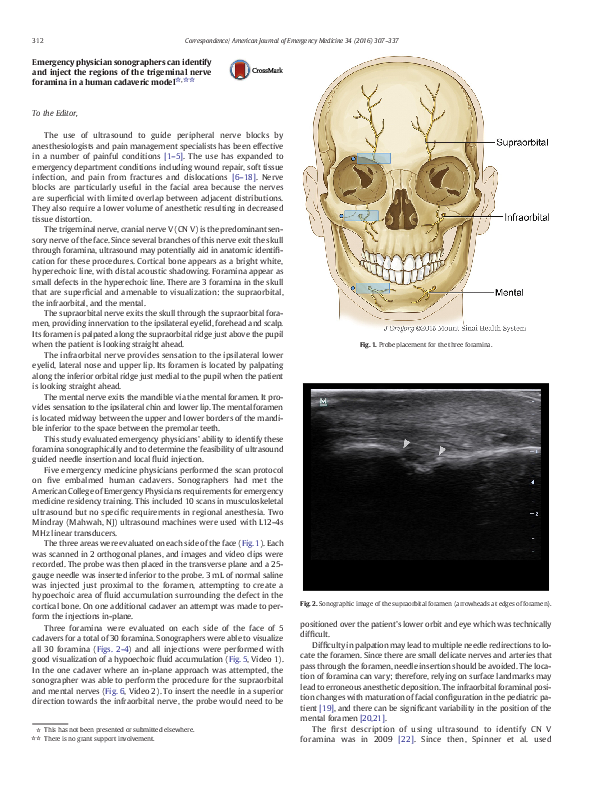 (PDF) Emergency physician sonographers can identify and inject the regions of the trigeminal ...