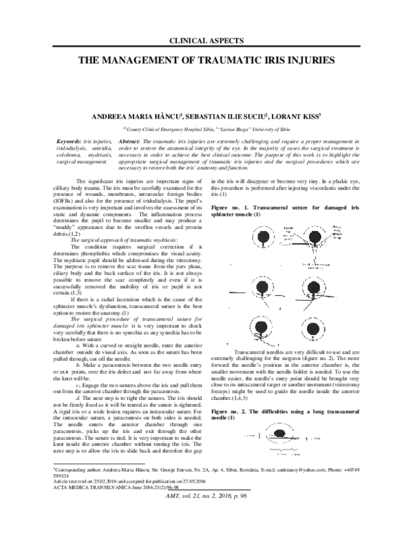 (PDF) The Management of Traumatic Iris Injuries