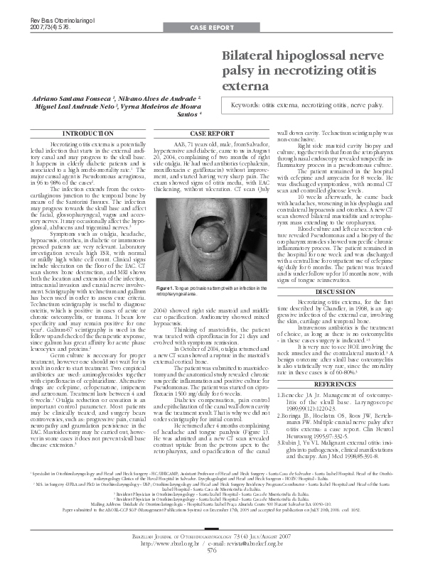 Pdf Bilateral Hipoglossal Nerve Palsy In Necrotizing Otitis Externa