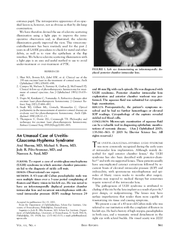 (PDF) An unusual case of uveitis-glaucoma-hyphema syndrome | ATUL ...