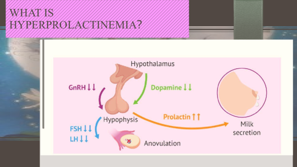 (PPT) What is hyperprolactinemia | Saraa. A Adel Aljadir - Academia.edu