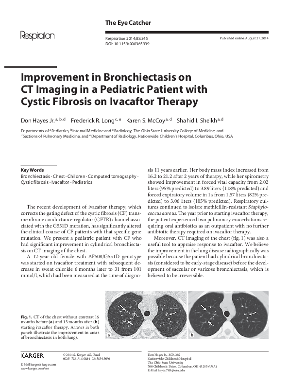 (PDF) Improvement in bronchiectasis on CT imaging in a pediatric ...