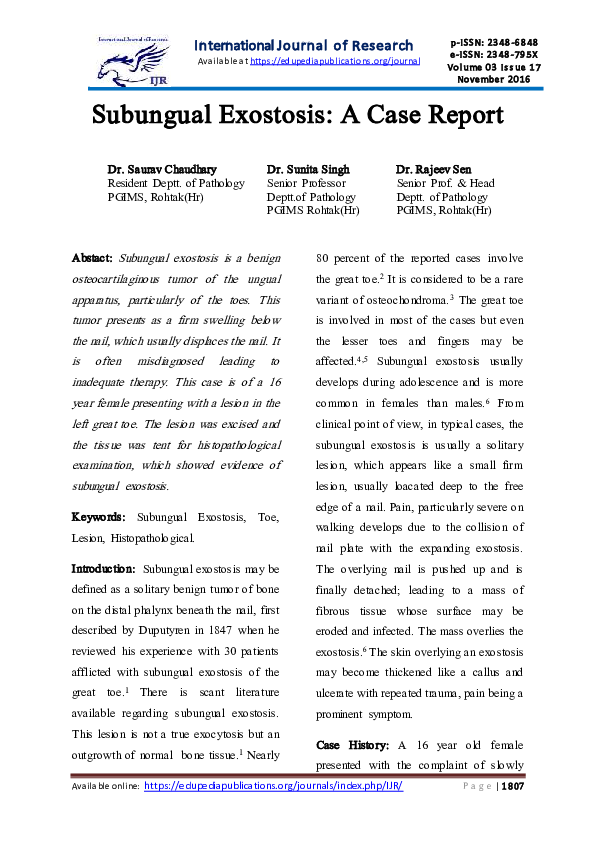 (PDF) Subungual Exostosis: A Case Report | Saurav Chaudhary - Academia.edu