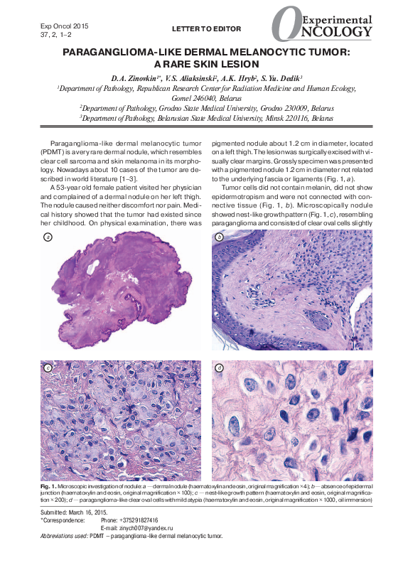 (PDF) PARAGANGLIOMA-LIKE DERMAL MELANOCYTIC TUMOR: A RARE SKIN LESION