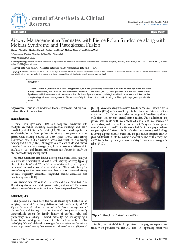 (PDF) Airway Management in Neonates with Pierre Robin Syndrome along ...