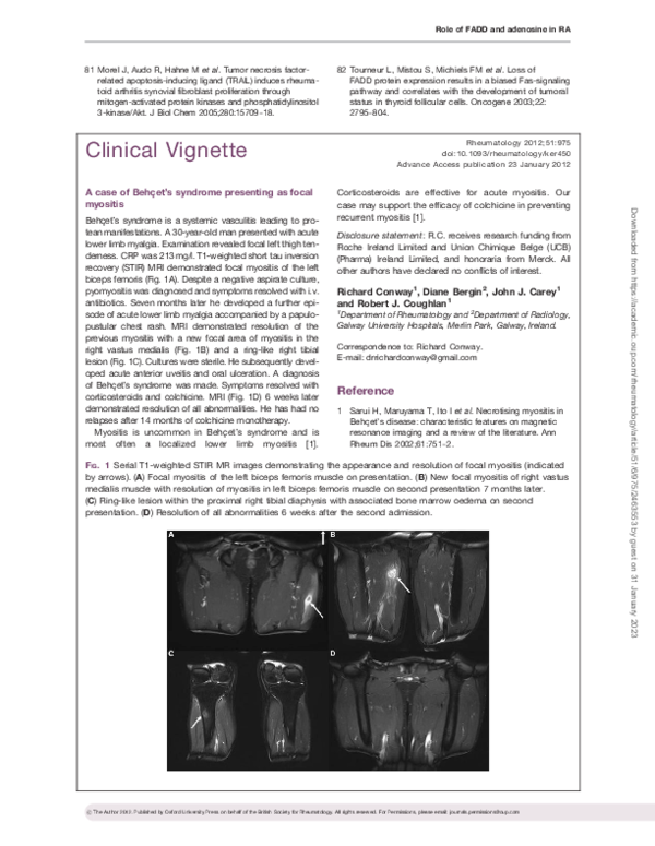 (PDF) A case of Behcet's syndrome presenting as focal myositis