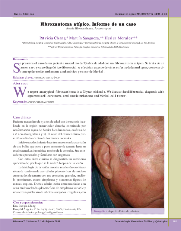 (PDF) Fibroxantoma atípico. Informe de un caso