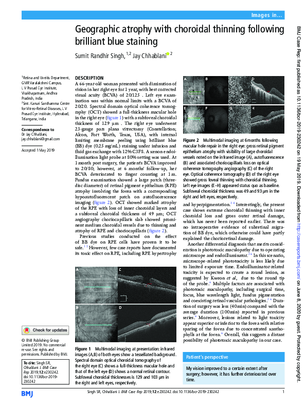 (PDF) Geographic atrophy with choroidal thinning following brilliant ...