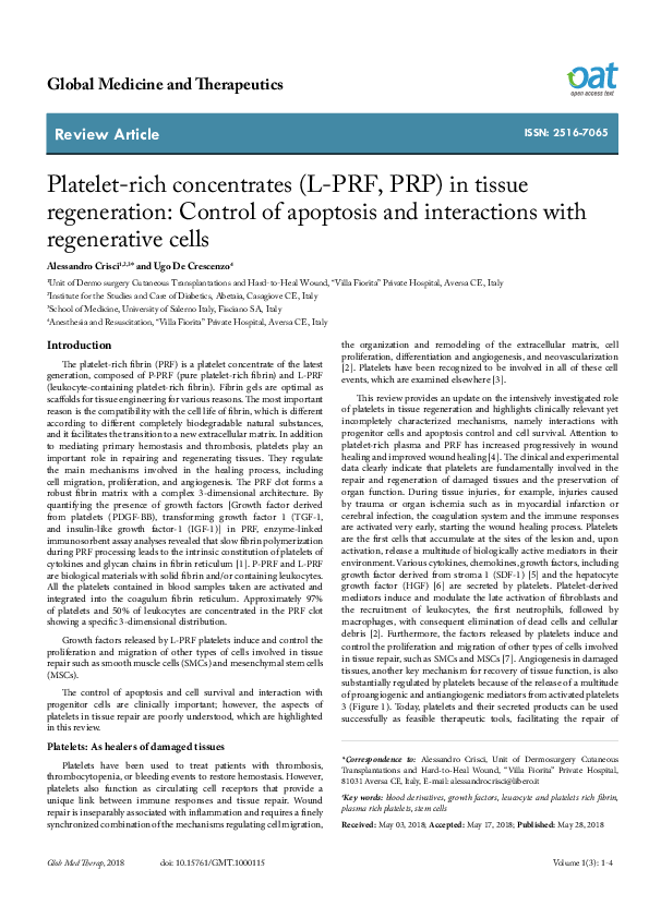 (PDF) Narcolepsy: A review amongst sleep disorders
