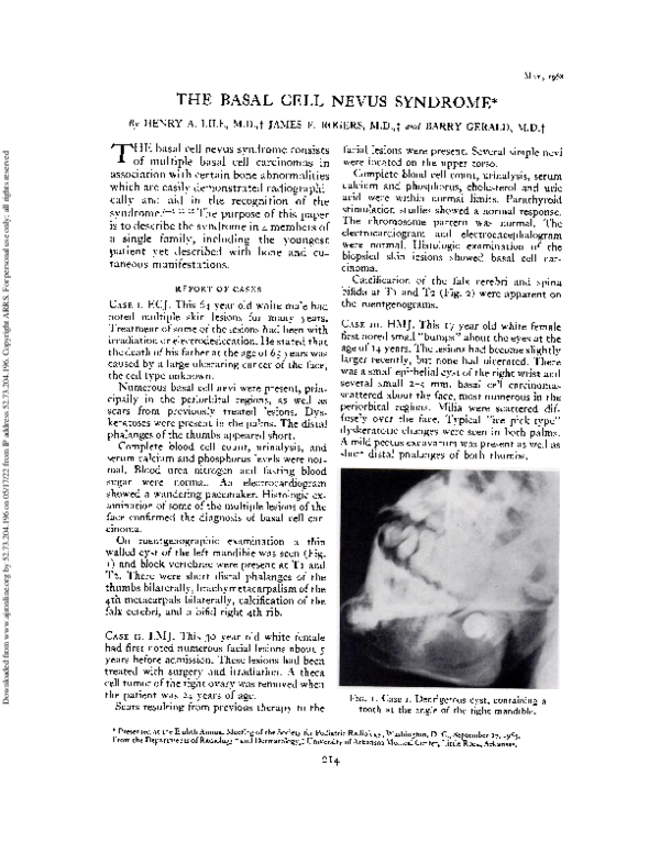 (PDF) The Basal Cell Nevus Syndrome | Eugene Epps - Academia.edu