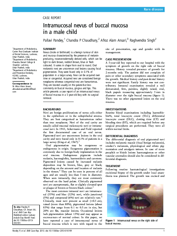 (PDF) Intramucosal nevus of buccal mucosa in a male child