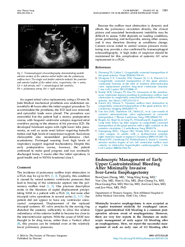 (PDF) Endoscopic Management of Early Upper Gastrointestinal Bleeding ...