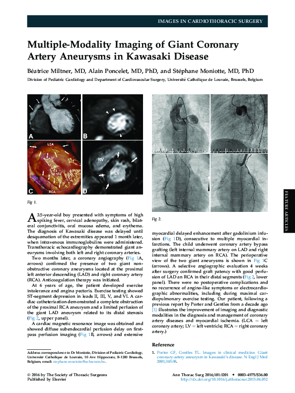 (PDF) Multiple-Modality Imaging of Giant Coronary Artery Aneurysms in ...