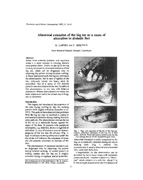 (PDF) Abnormal extension of the big toe as a cause of ulceration in ...