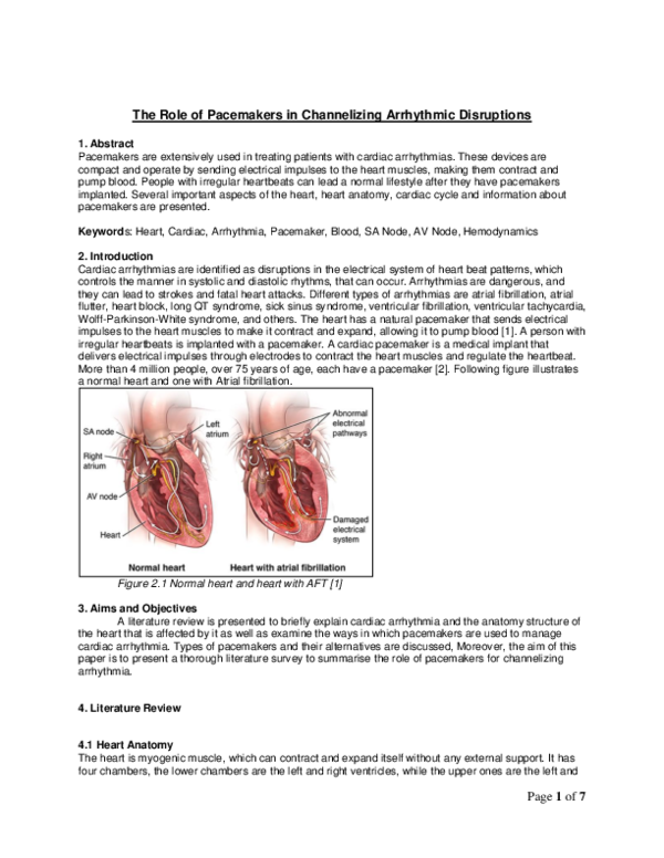 (PDF) Using Microelectronics In Pace Makers To Treat Arrhythmia ...