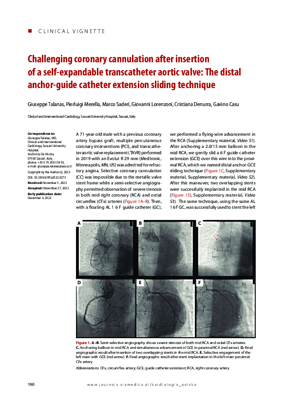 (PDF) Challenging coronary cannulation after insertion of a self ...