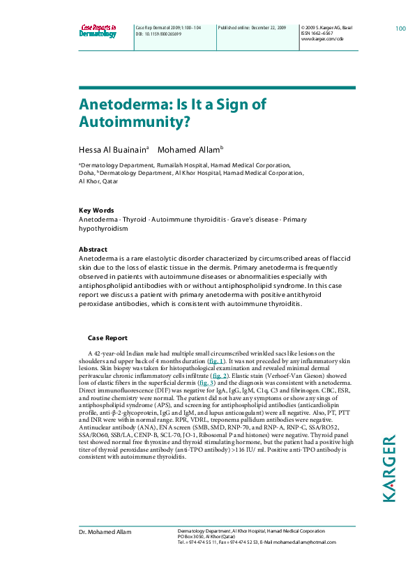 (PDF) Anetoderma: Is It a Sign of Autoimmunity?