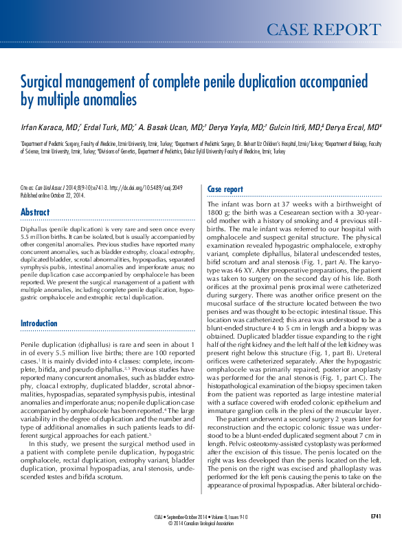 (PDF) Surgical management of complete penile duplication accompanied by ...