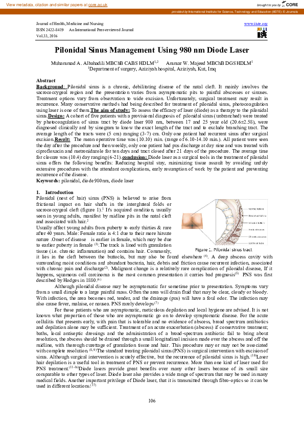 (PDF) Pilonidal Sinus Management Using 980 nm Diode Laser