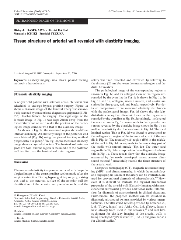 (PDF) Tissue structure of arterial wall revealed with elasticity imaging