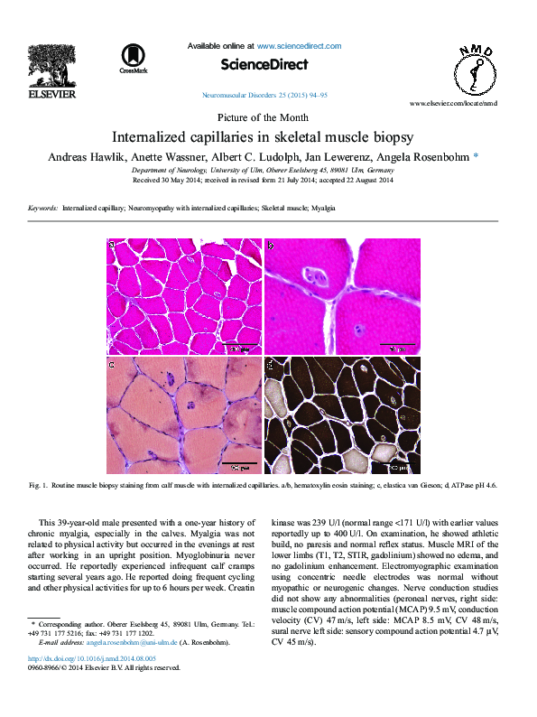 (PDF) Internalized capillaries in skeletal muscle biopsy | Anette ...