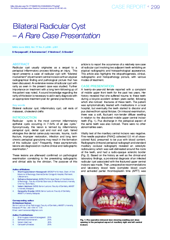(PDF) Bilateral Radicular Cyst – A Rare Case Presentation