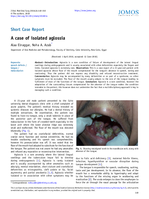 (PDF) A case of isolated aglossia | Alaa Elnaggar - Academia.edu
