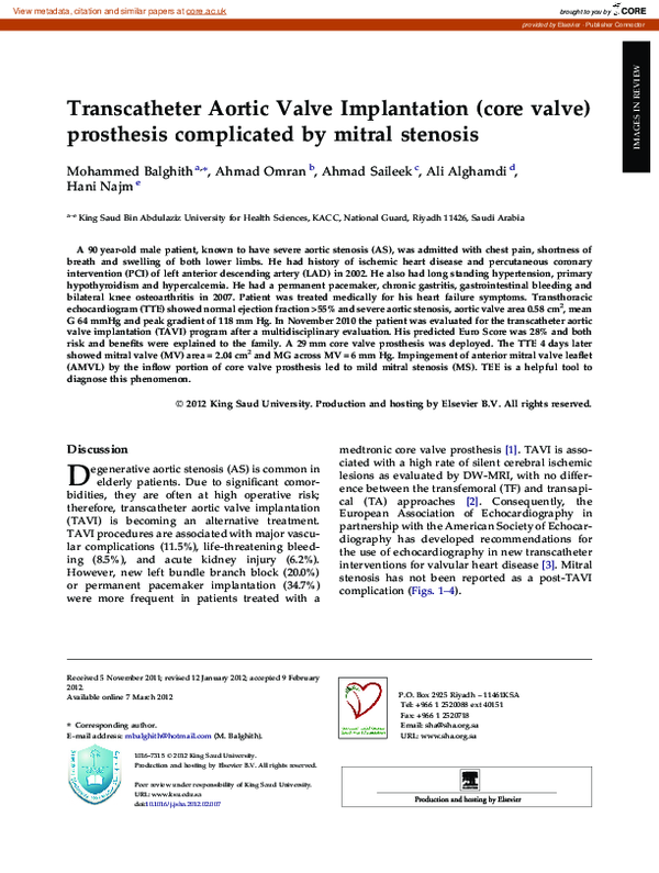 (PDF) Transcatheter Aortic Valve Implantation (core valve) prosthesis complicated by mitral stenosis