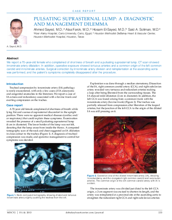 Pdf Pulsating Suprasternal Lump A Diagnostic And Management Dilemma