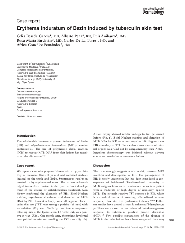 (PDF) Erythema induratum of Bazin induced by tuberculin skin test ...