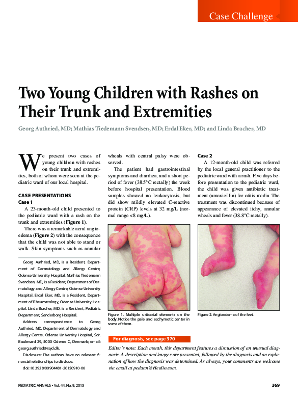 (PDF) Two Young Children with Rashes on Their Trunk and Extremities ...