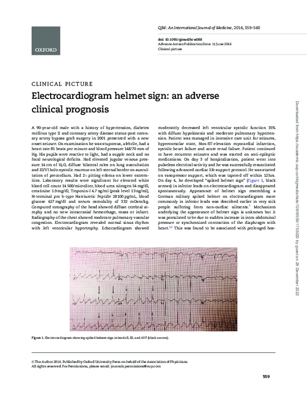 (PDF) Electrocardiogram helmet sign: an adverse clinical prognosis