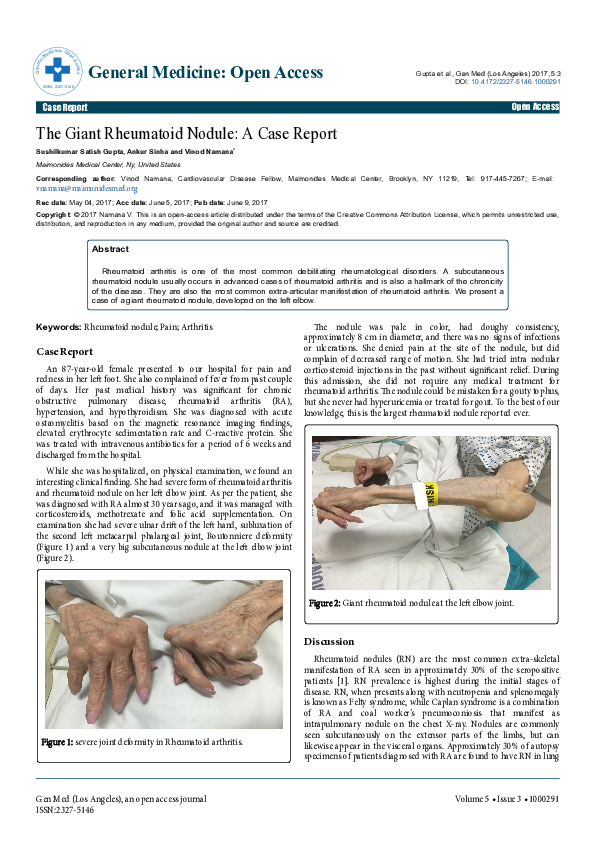 (PDF) The Giant Rheumatoid Nodule: A Case Report