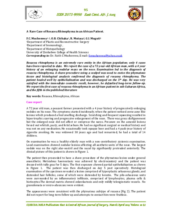 (PDF) A Rare case of Rosacea Rhinophyma in an African Patient