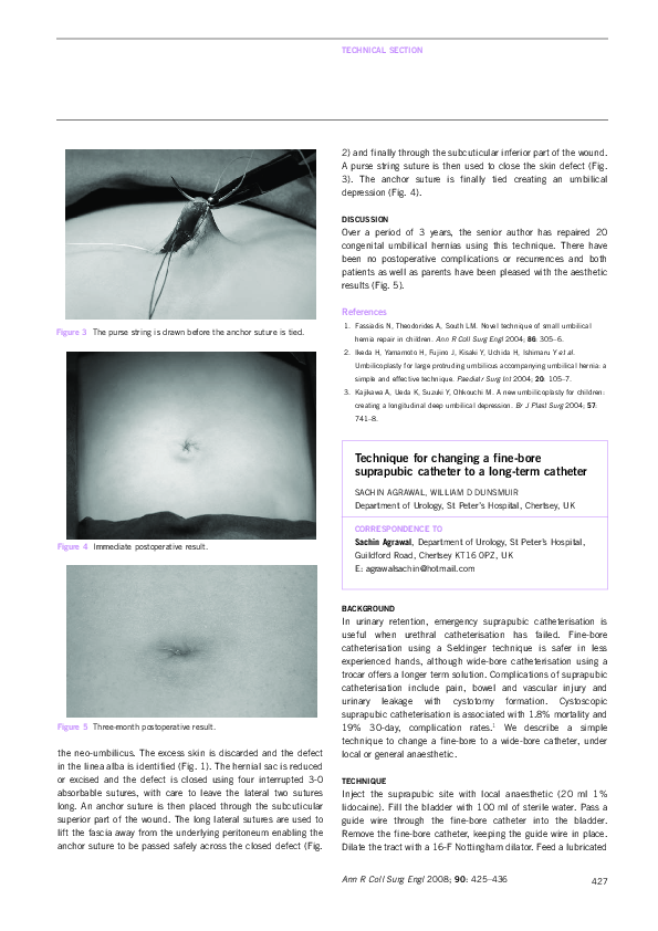 (PDF) Technique for changing a fine-bore suprapubic catheter to a long ...