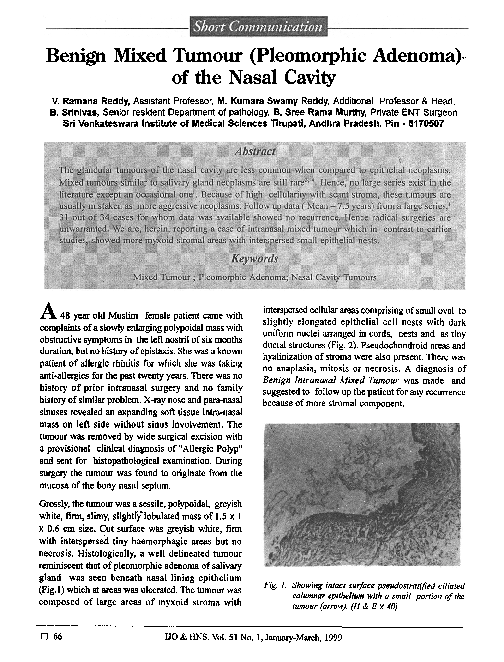 (PDF) Benign mixed tumour (pleomorphic adenoma) of the nasal cavity