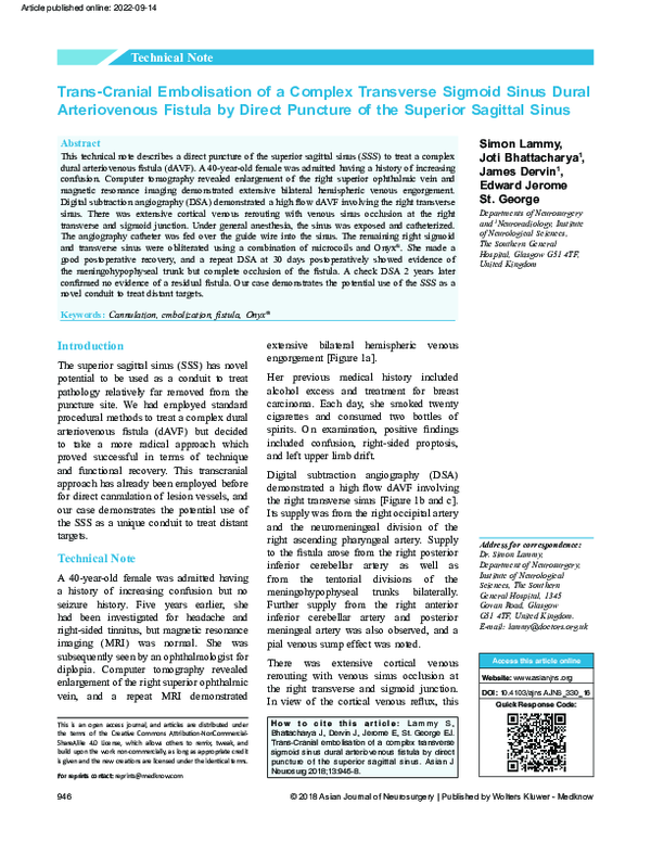 (PDF) Trans-Cranial embolisation of a complex transverse sigmoid sinus ...