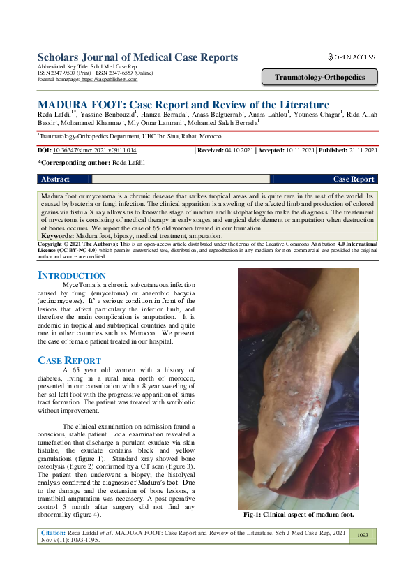 (PDF) MADURA FOOT: Case Report and Review of the Literature