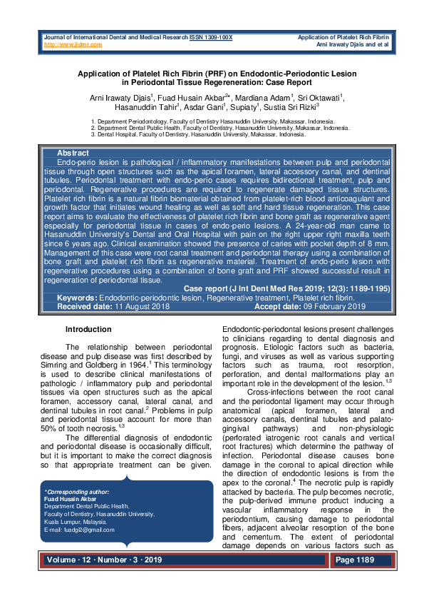 (PDF) Application of Platelet Rich Fibrin ( PRF ) on Endodontic ...