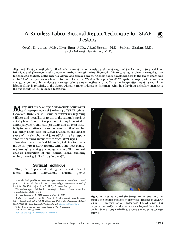 (PDF) A Knotless Labro-Bicipital Repair Technique for SLAP Lesions